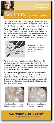 ADA Brochure: Sealants Quick Reference Card – Smart Practice Australia
