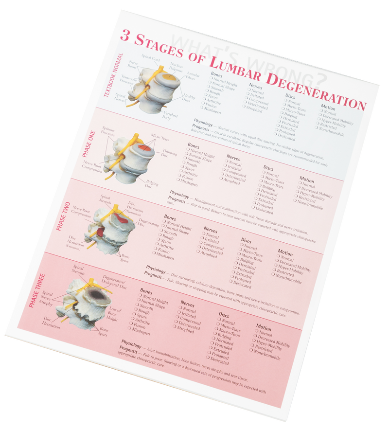 3 Stages of Lumbar Degeneration Handout – Smart Practice Australia